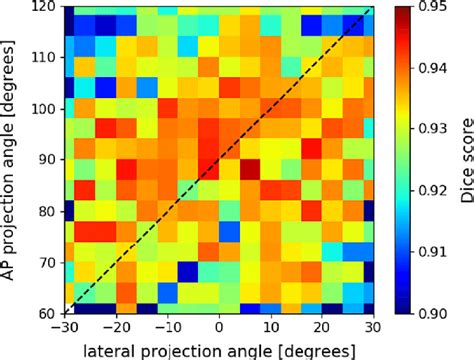 Dice Scores For Different Biplanar Configurations Projection Angles