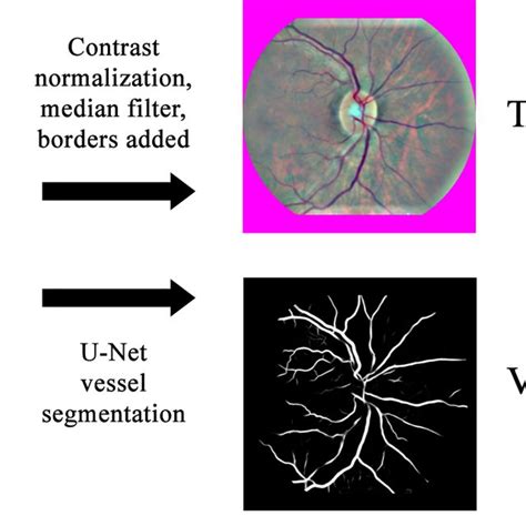 Retinal Image Preprocessing Procedure Download Scientific Diagram