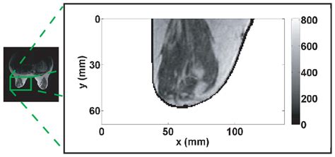 A Slice Of The Original MRI Image And The Segmentation Stage Of The Download Scientific Diagram