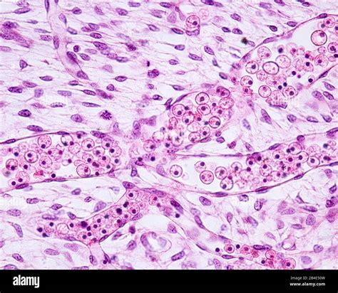 Simple Squamous Epithelium In Microscope