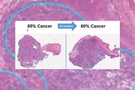 Webinars Science Lab Leica Microsystems