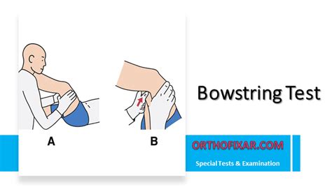 Weber Test Interpretation Explained Easily Orthofixar