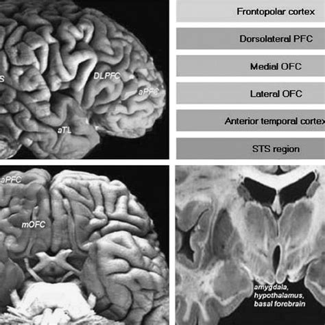 Brain Regions Implicated In Human Moral Cognition Adapted From Moll Download Scientific