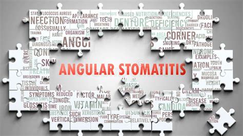 angular stomatitis as a complex subject related to various topics and