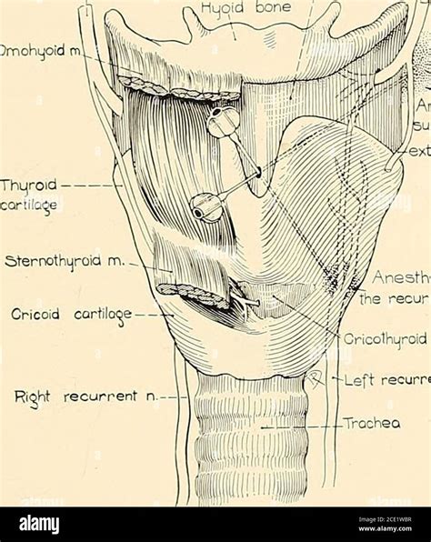 Thyroid Notch