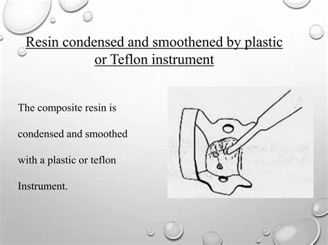 Preventive Resin Restoration PPTX Preventive Resin Restoration PPTX