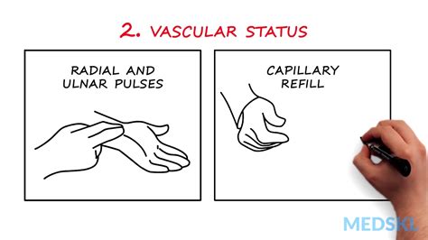 Hand And Or Wrist Injuries How To Easily Test Nerve Function Youtube