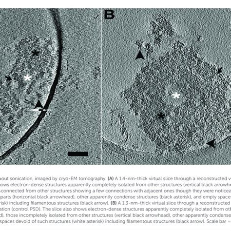Cryo Em Tomography And Subsequent Segmentation Of Two Sonicated Psds Download Scientific
