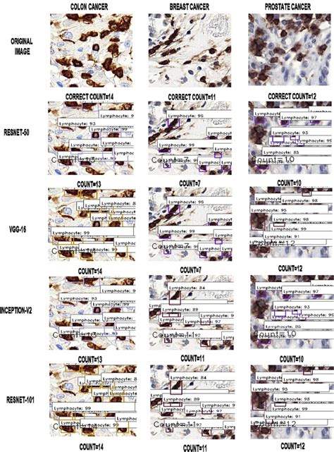Lymphocyte Detection And Count In Image Patches With Group Of