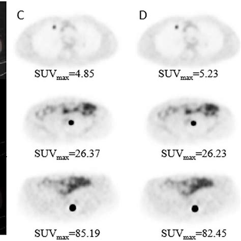 Patient Images Reconstructed By Different Algorithms Patient With Download Scientific Diagram
