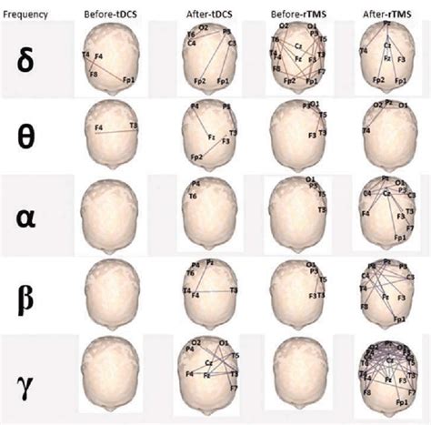 Change In Functional Connectivity From An EEG Based Analysis In Download Scientific Diagram
