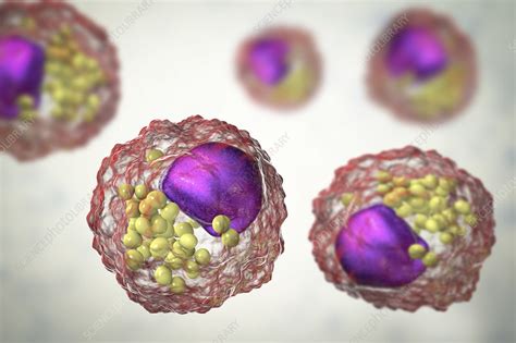 Macrophage Foam Cell Illustration Stock Image F Science Photo Library