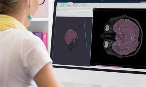 Online Course Image Segmentation Filtering And Region Analysis From