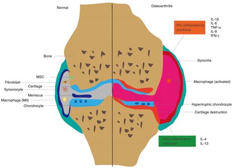 Role Of Crosstalk Between Synovial Cells And Chondrocytes In Osteoarthritis Review