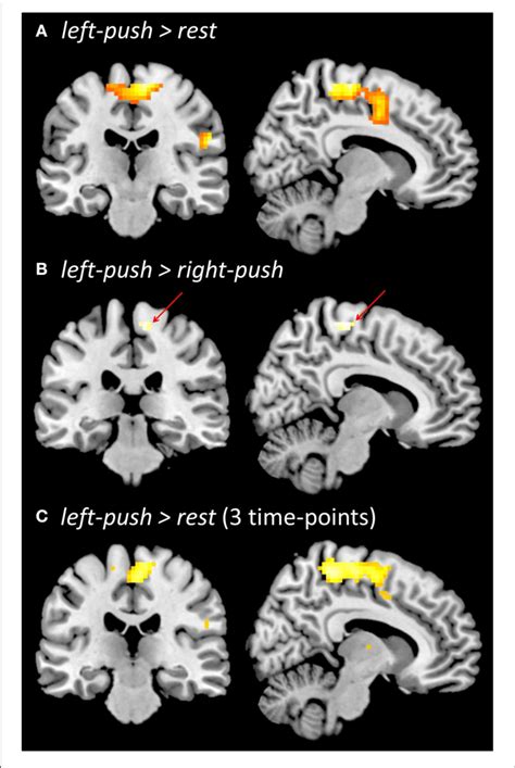 Functional Brain Activation During Pushing One Foot Onto The