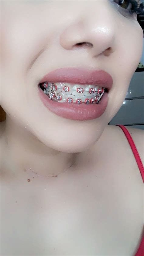 Brakets Color Rojo Ligas Para Brackets Dientes Con Brackets