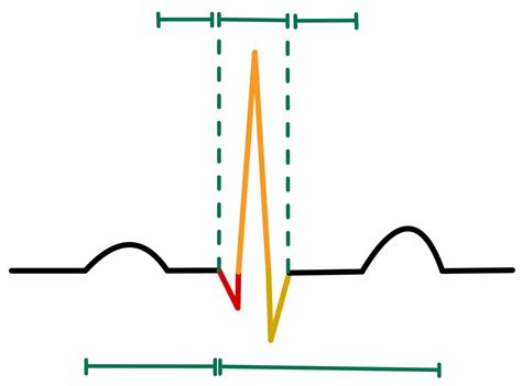 Diagram Of Normal Ecg Quizlet
