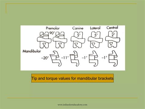 Tip Edge Technique Final PPT Tip Edge Technique Final PPT
