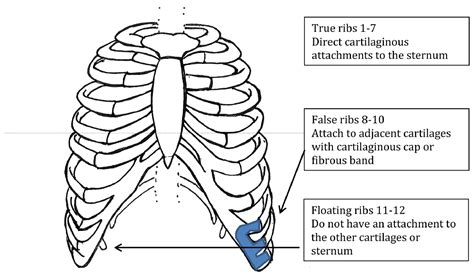Floating Rib Syndrome Mayo Clinic Ask The Mayo Mom Podcast Chest Wall