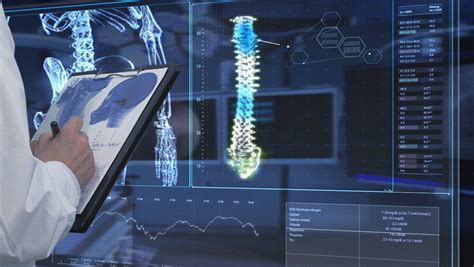 Sténose Foraminale Décompression Neurovertébrale