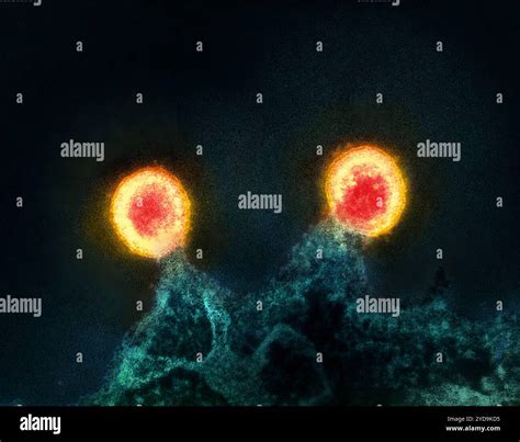 Colorized Transmission Electron Micrograph Of Two Hiv 1 Virus Particles Red Yellow Budding From