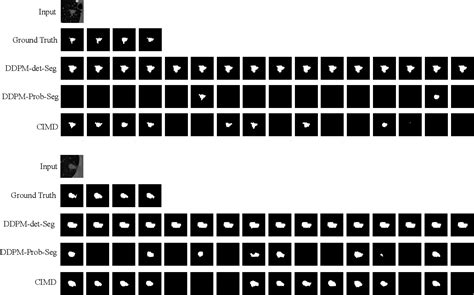 Figure 2 From Ambiguous Medical Image Segmentation Using Diffusion