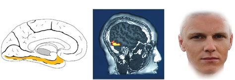 93 Neural Structures Involved In Memory And Learning Brain And Behavior
