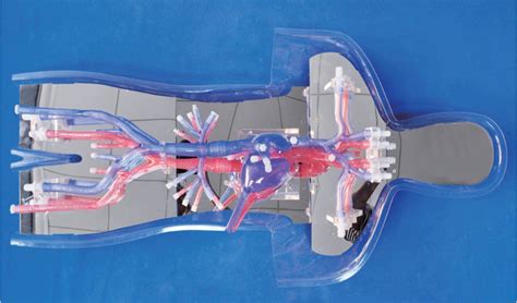 Extra Corporeal Membrane Oxygenation Ecmo Knowledge