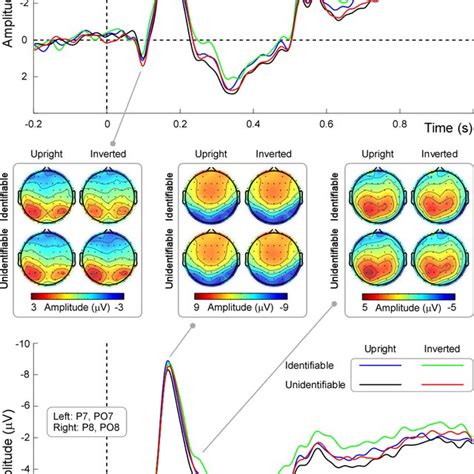 Group Level Average ERP Waveforms In Different Experimental Conditions Download Scientific