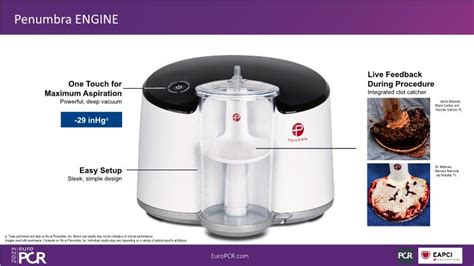 Primary Percutaneous Pulmonary Intervention Pppi Of Acute Pulmonary Embolism With Computer