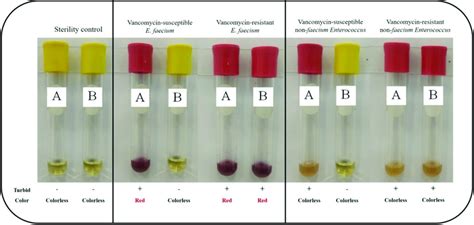 Interpretation Of In House Vrefm Screening Broth For Download Scientific Diagram