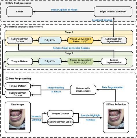 The Framework Of Two Stage Sublingual Veins Segmentation Method Download Scientific Diagram