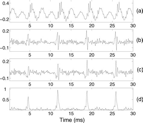 A Segment Of Voiced Speech B Lp Residual C Hilbert Transform Of Download Scientific