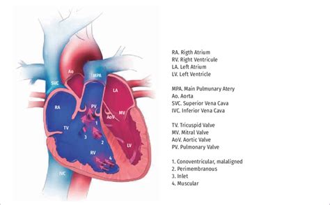 Interventricular Communication Q21 0 Download Scientific Diagram