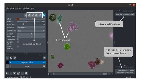 Segment — Celldetective 1 2 Documentation
