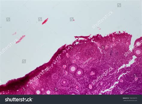 Cross Section Human Ovary Under Microscope ภาพสต็อก 736539475