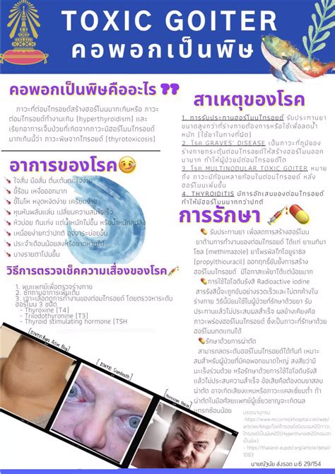 Toxic Goiter Pdf