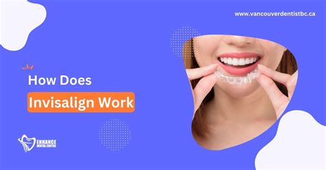 The Complete Guide On How Invisalign Works Enhance Dental Care