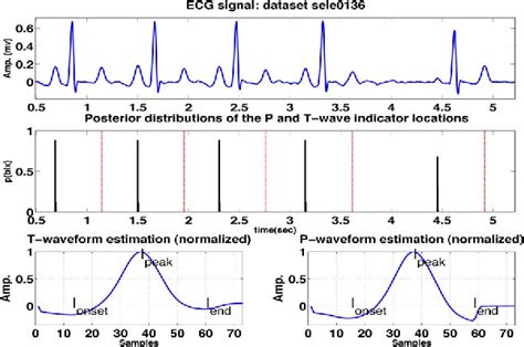 Figure 2 From P And T Wave Delineation In Ecg Signals Using A Bayesian