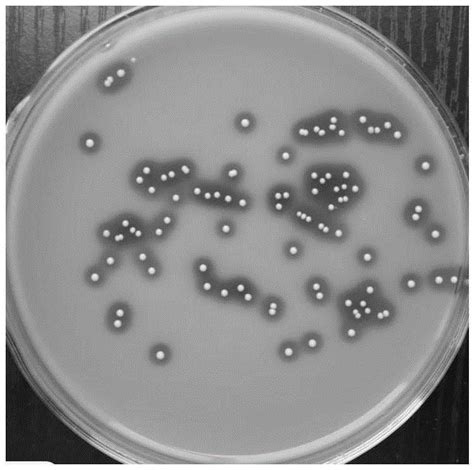 Acid Yielding Enterococcus Faecium Bacteriostatic Microecological Preparation And Application