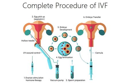 Ivf 2025 Basic Principles Ivf Procedure In India 2025 Ivf 2025 Basic Principles Ivf Procedure In India 2025