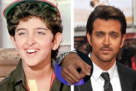 بیماری های مادرزادی ریتیک روشن بازیگر معروف هندی از ۱۱ انگشتی بودنش