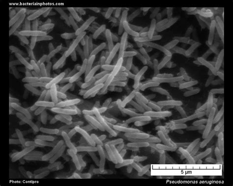 Scanning Electron Micrograph Sem Of Bacterial Biofilm Formed By Pseudomonas Aeruginosa Formed