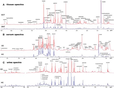 Nmr In Metabolomics A Non Destructive Tool For Biomarker Discovery Creative Biostructure