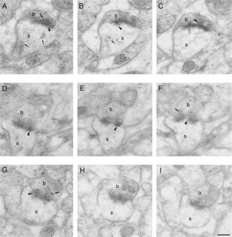 Electron Micrographs Of Serial Sections Through Anti ␣ 7 Nachr Labeled