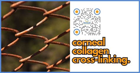 Corneal Collagen Cross Linking In Manila Treatment For Keratoconus Roque Eye Clinic Ph