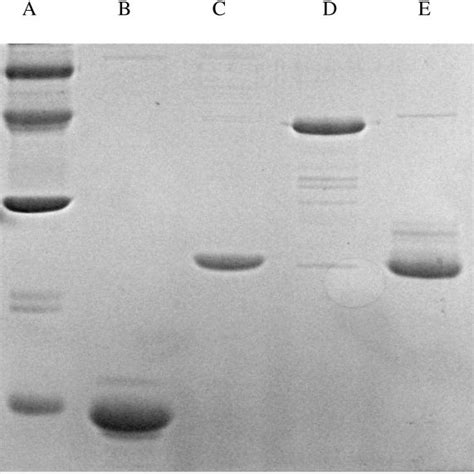 Recombinant Antigens After Purification Sds Page Gel Of The Download Scientific Diagram