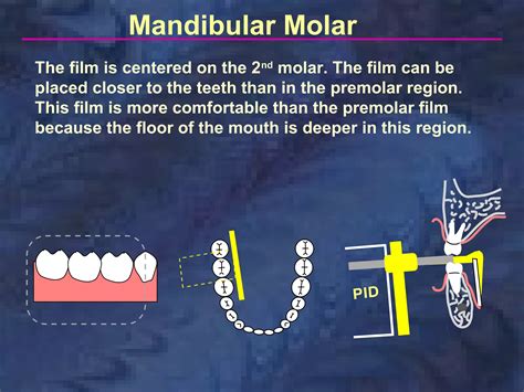 Paralleling Technique Ppt