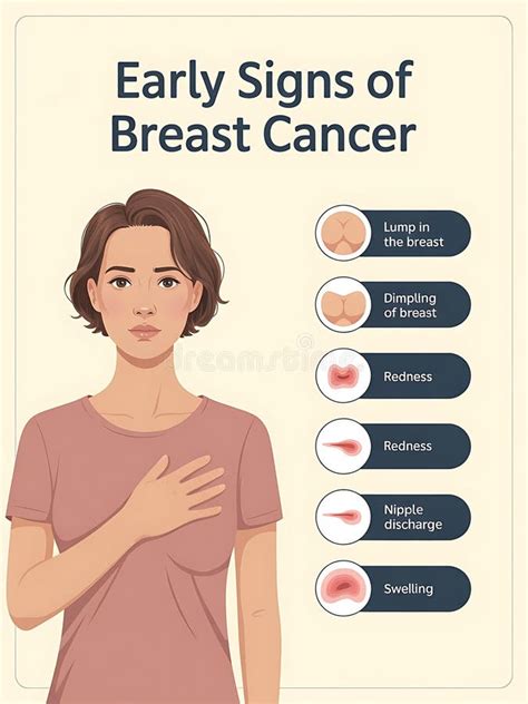 Early Signs Of Breast Cancer Infographic In Flat Vector Style Educational Style Stock