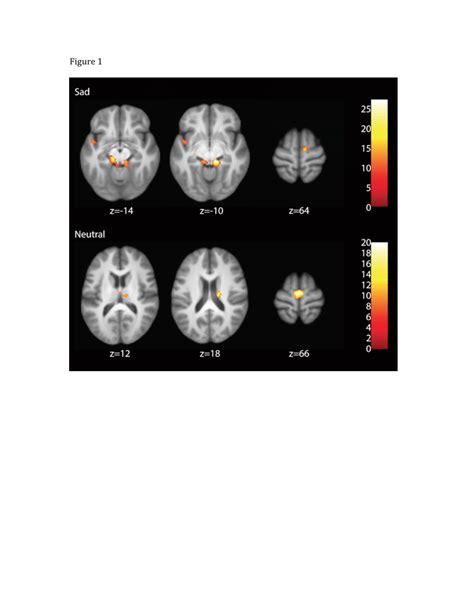 Fmri Results Of The Interaction Of Diagnosis And Sex Download